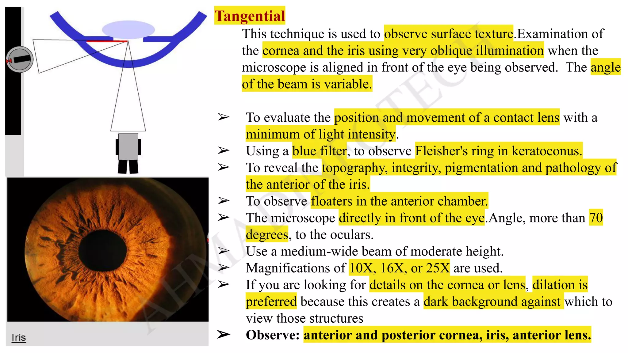 what is slit lamp Biomicroscopy | What is a slit lamp exam used for ...