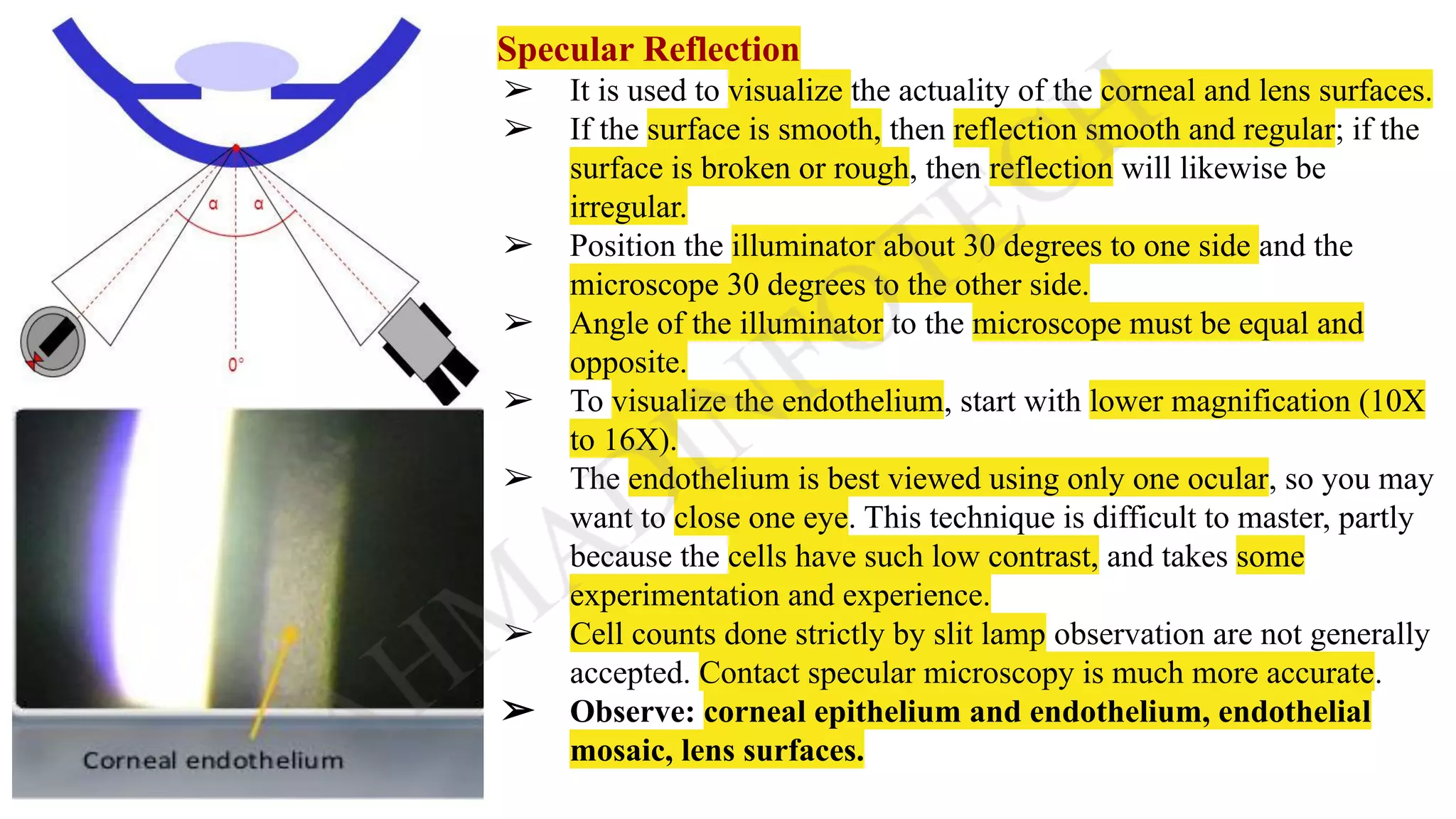 what is slit lamp Biomicroscopy | What is a slit lamp exam used for ...