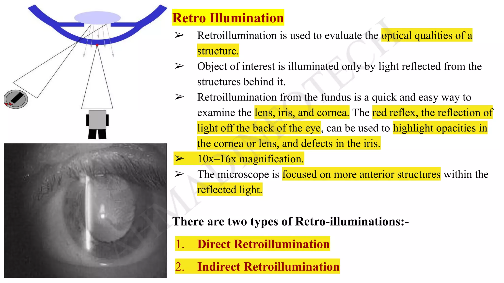 what is slit lamp Biomicroscopy | What is a slit lamp exam used for ...