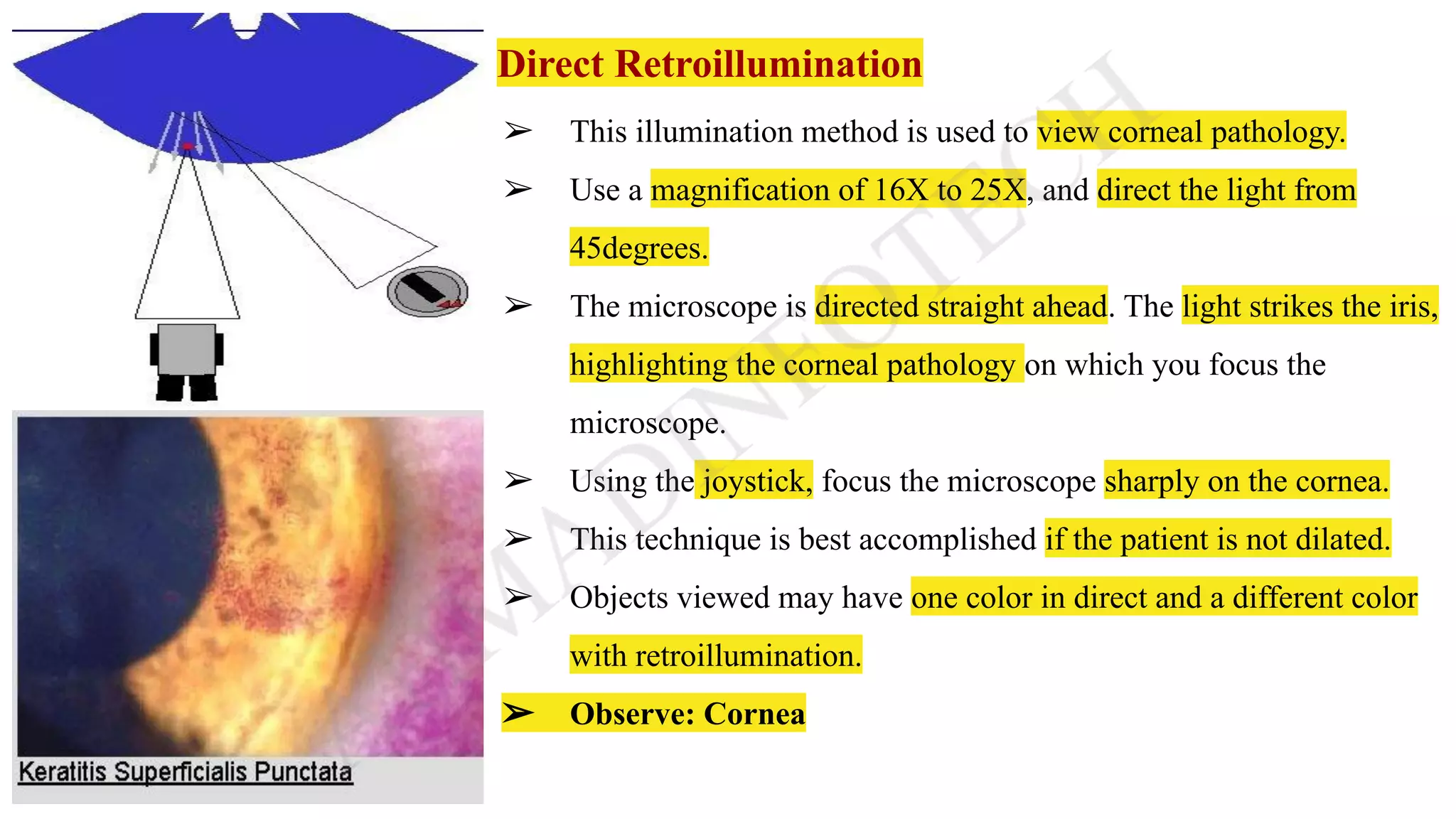 what is slit lamp Biomicroscopy | What is a slit lamp exam used for ...