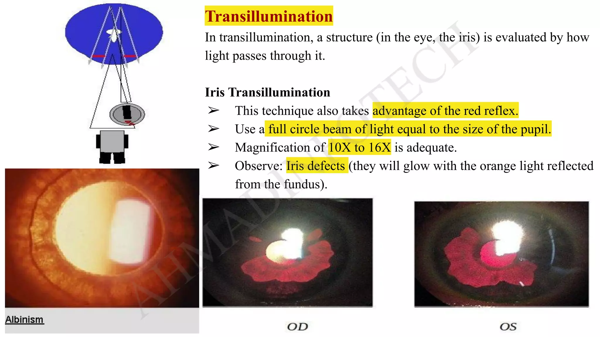 what is slit lamp Biomicroscopy | What is a slit lamp exam used for ...