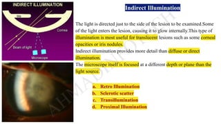 what is slit lamp Biomicroscopy | What is a slit lamp exam used for ...