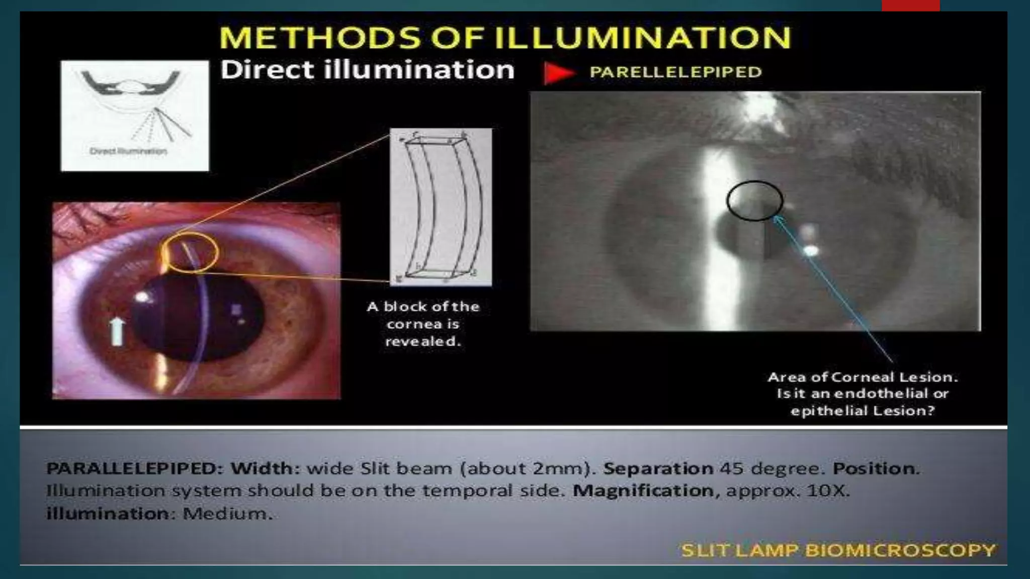 Slit_lamp_and_bio_microscopy_.pptx