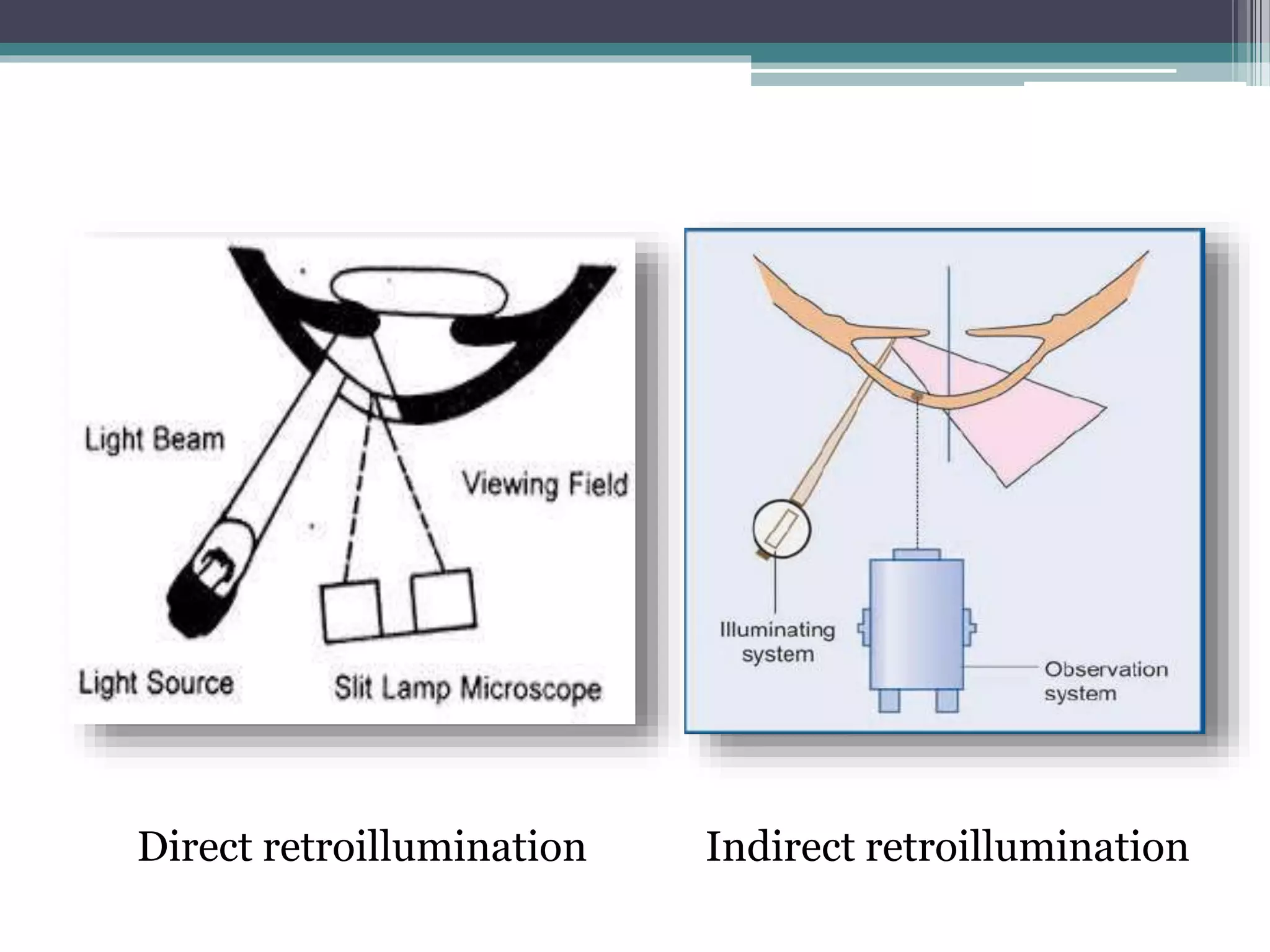 SLIT LAMP AND ITS DIFFERENT ILLUMINATION TECHNIQUES.pptx