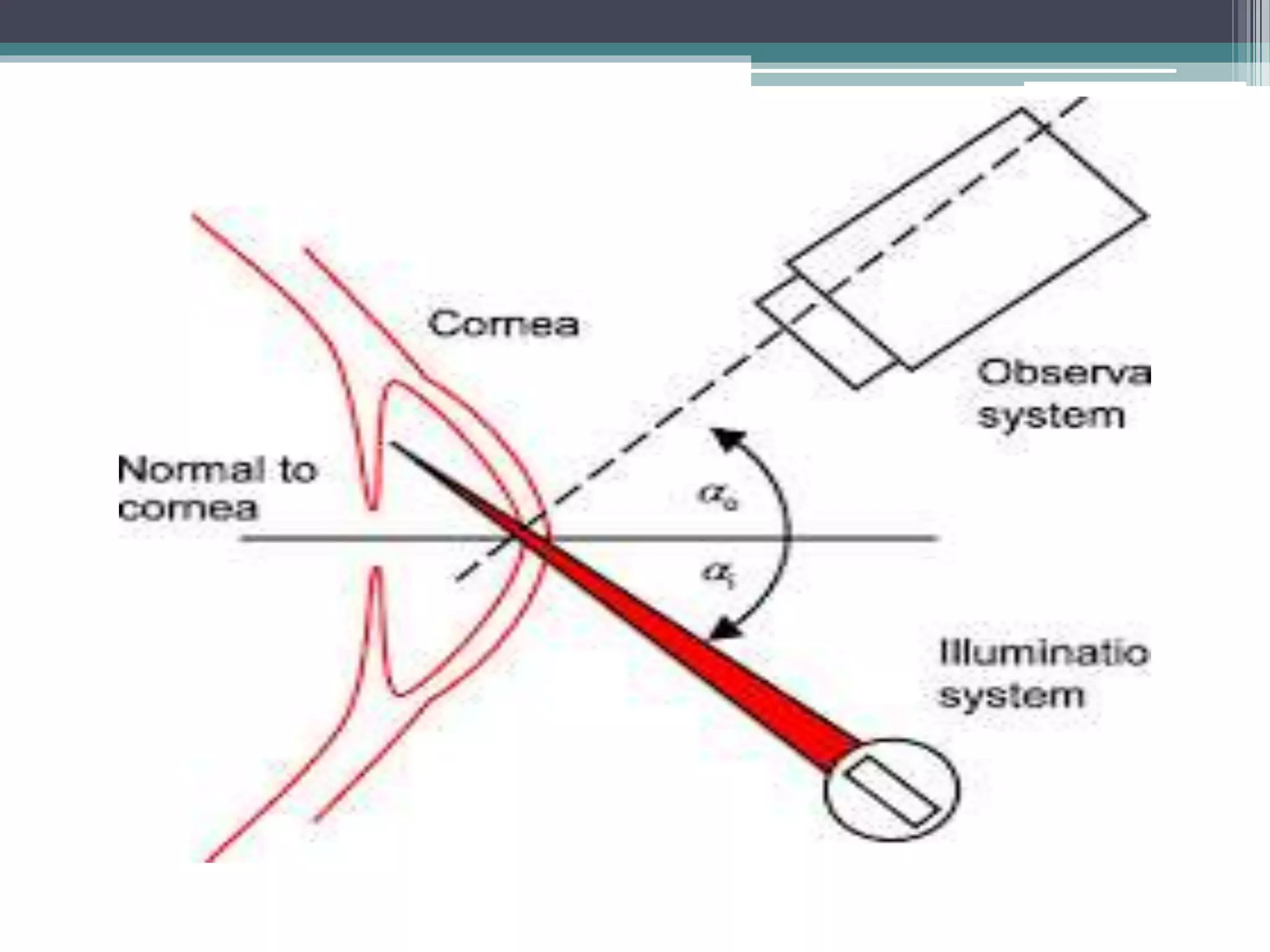 SLIT LAMP AND ITS DIFFERENT ILLUMINATION TECHNIQUES.pptx