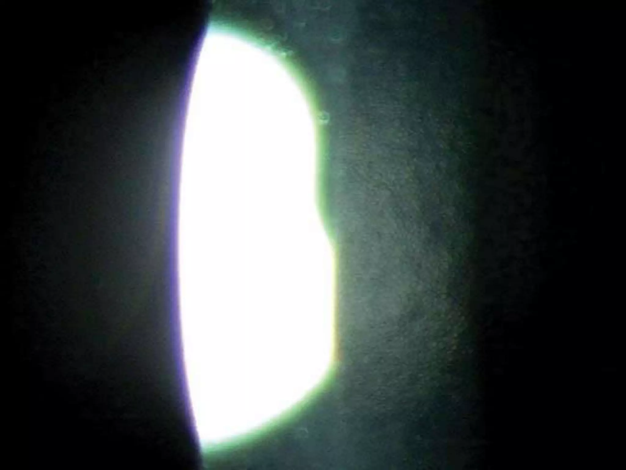 SLIT LAMP AND ITS DIFFERENT ILLUMINATION TECHNIQUES.pptx
