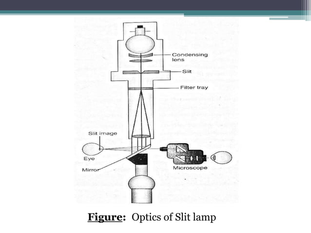 SLIT LAMP AND ITS DIFFERENT ILLUMINATION TECHNIQUES.pptx | Eye and ...