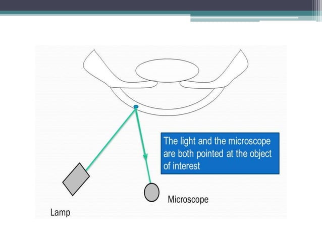 SLIT LAMP AND ITS DIFFERENT ILLUMINATION TECHNIQUES.pptx | Eye and ...