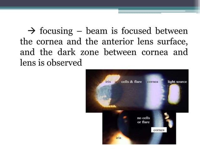 SLIT LAMP AND ITS DIFFERENT ILLUMINATION TECHNIQUES.pptx | Eye and ...