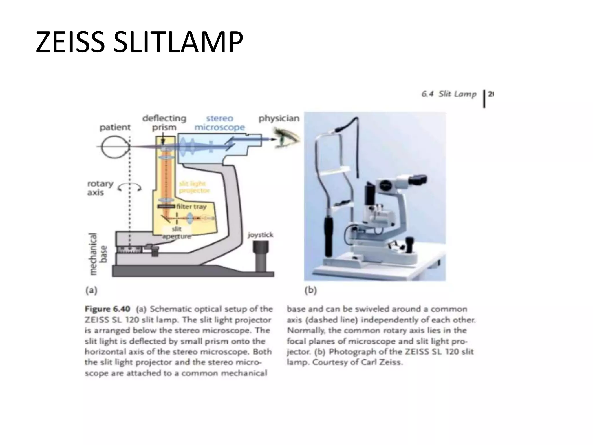 Slitlamp bimicroscopy | PPTX