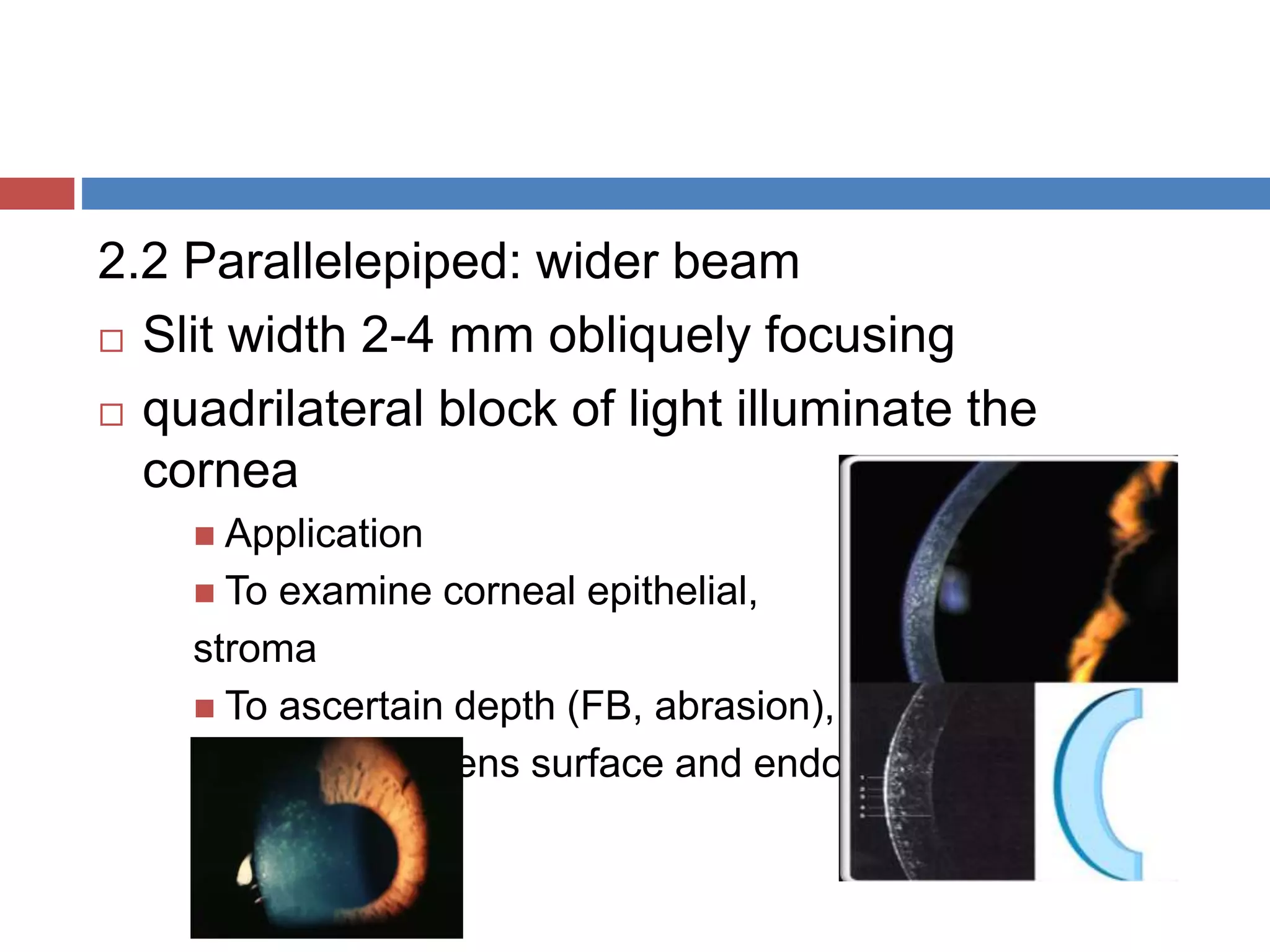 Slit lamp in Ophthalmology | PPTX
