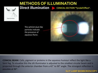 Slit lamp biomicroscopy. | PPTX