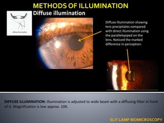 Slit lamp biomicroscopy. | PPTX