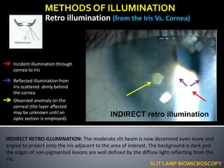 Slit lamp biomicroscopy. | PPTX