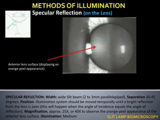 Slit lamp biomicroscopy. | PPTX