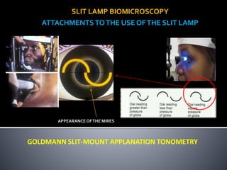 Slit lamp biomicroscopy. | PPTX
