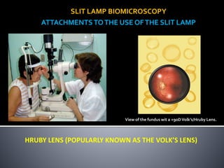 Slit lamp biomicroscopy. | PPTX