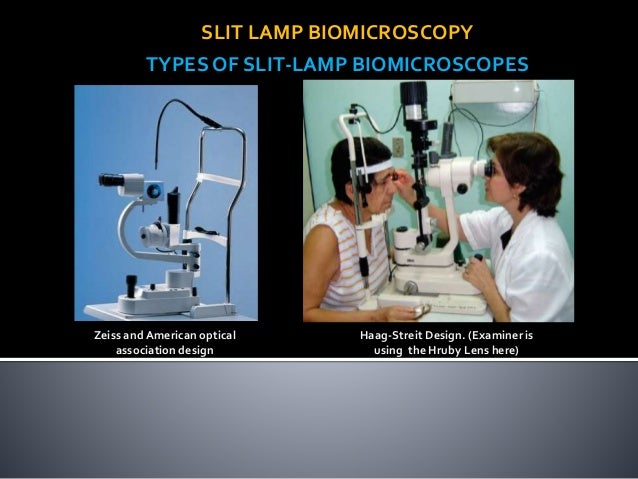 Slit lamp biomicroscopy.