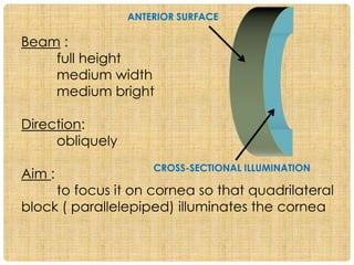 Corneal Parallelepiped