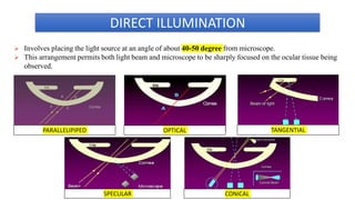 SLIT LAMP BIOMICROSCOPY Dr. Debarnab Dey | PPTX