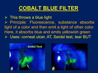 Slit lamp biomicroscopy | PPT
