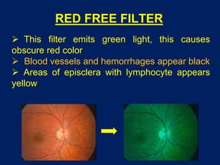 Slit lamp biomicroscopy | PPT