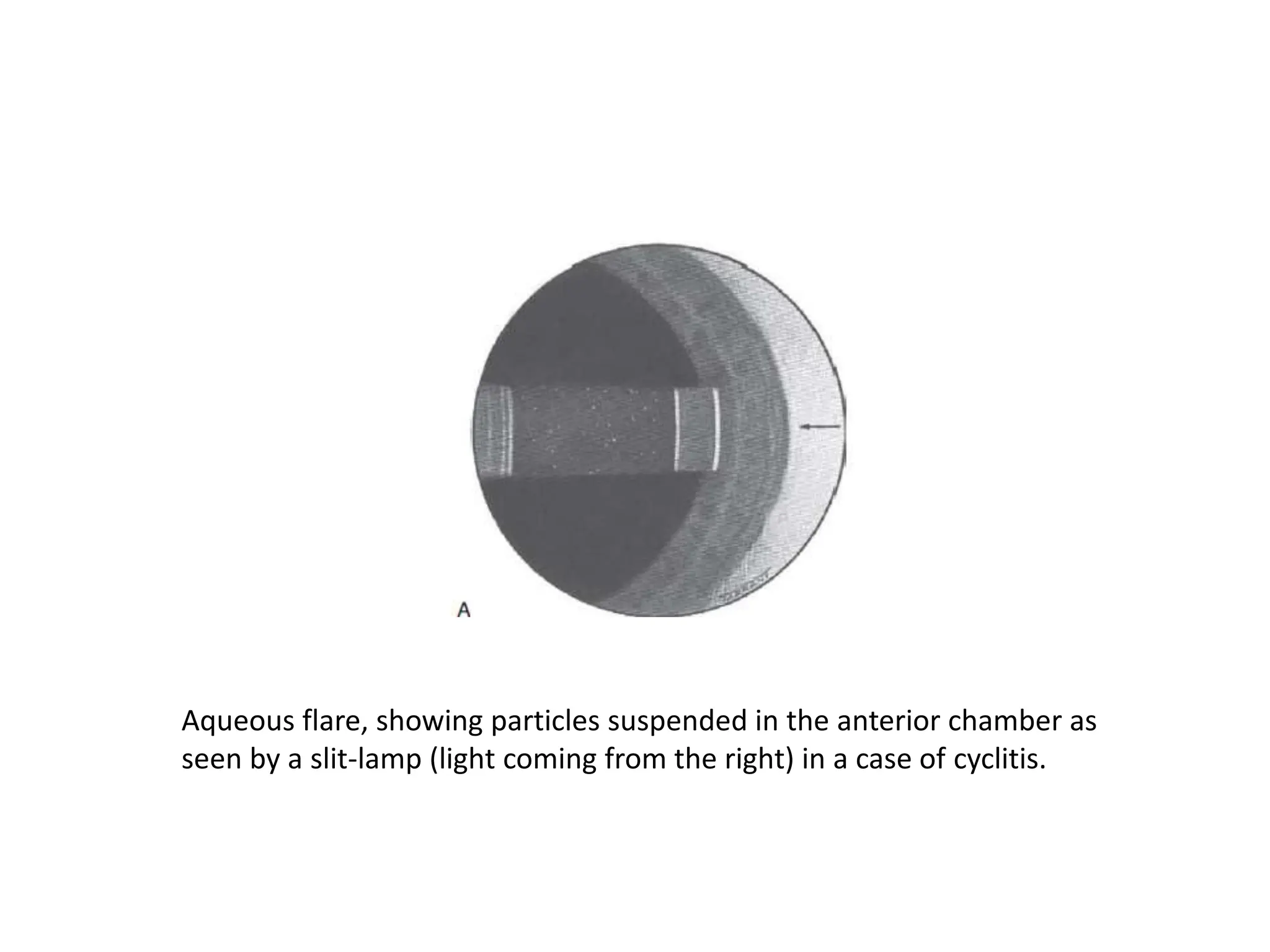 Slit Lamp Biomicroscopy.ecamination , types and procedures | PPTX