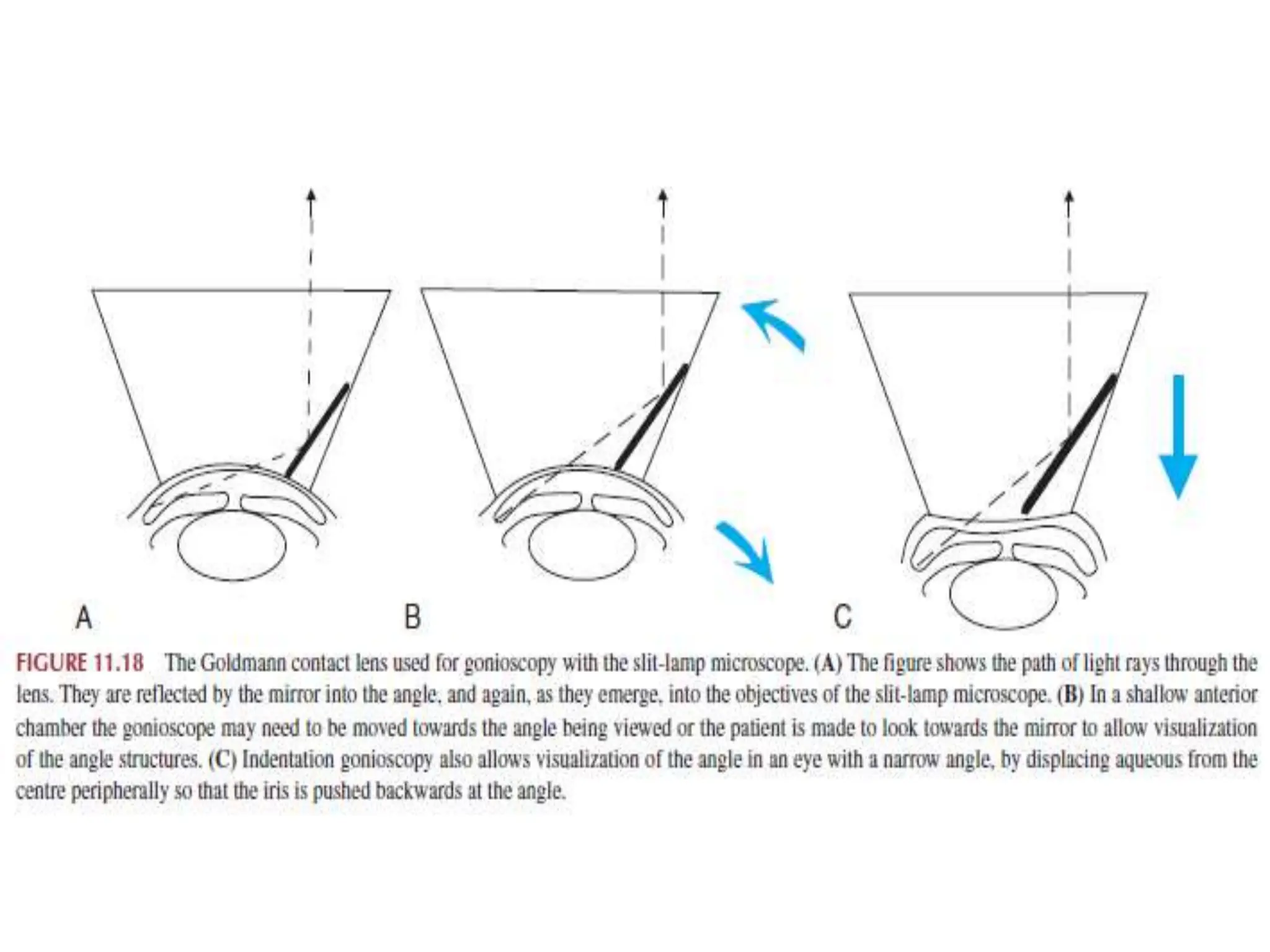 Slit Lamp Biomicroscopy.ecamination , types and procedures | PPT