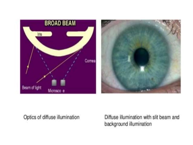 Slit Lamp Biomicroscopy.ecamination , types and procedures | PPT