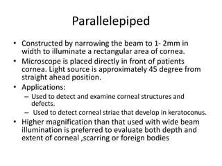 Slit Lamp Biomicroscopy.ecamination , types and procedures | PPTX