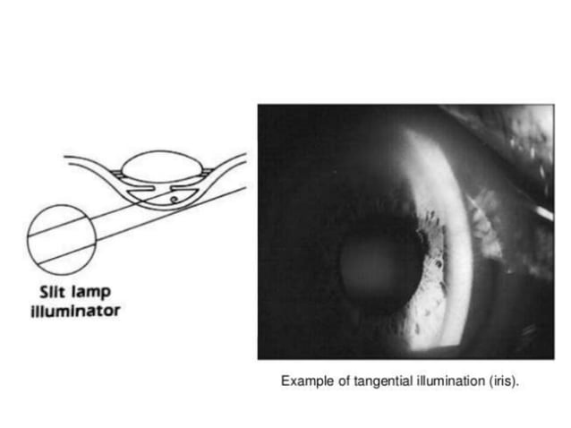 Slit Lamp Biomicroscopy.ecamination , types and procedures | PPT