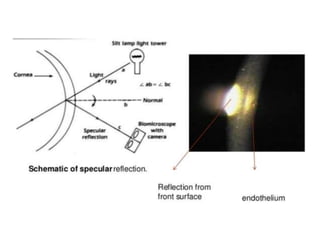 Slit Lamp Biomicroscopy.ecamination , types and procedures | PPTX