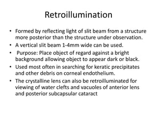 Slit Lamp Biomicroscopy.ecamination , types and procedures | PPTX