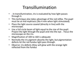 Slit Lamp Biomicroscopy.ecamination , types and procedures | PPTX