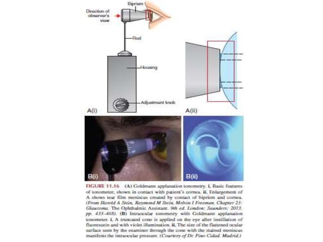 Slit Lamp Biomicroscopy.ecamination , types and procedures | PPT