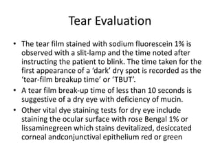 Slit Lamp Biomicroscopy.ecamination , types and procedures | PPTX