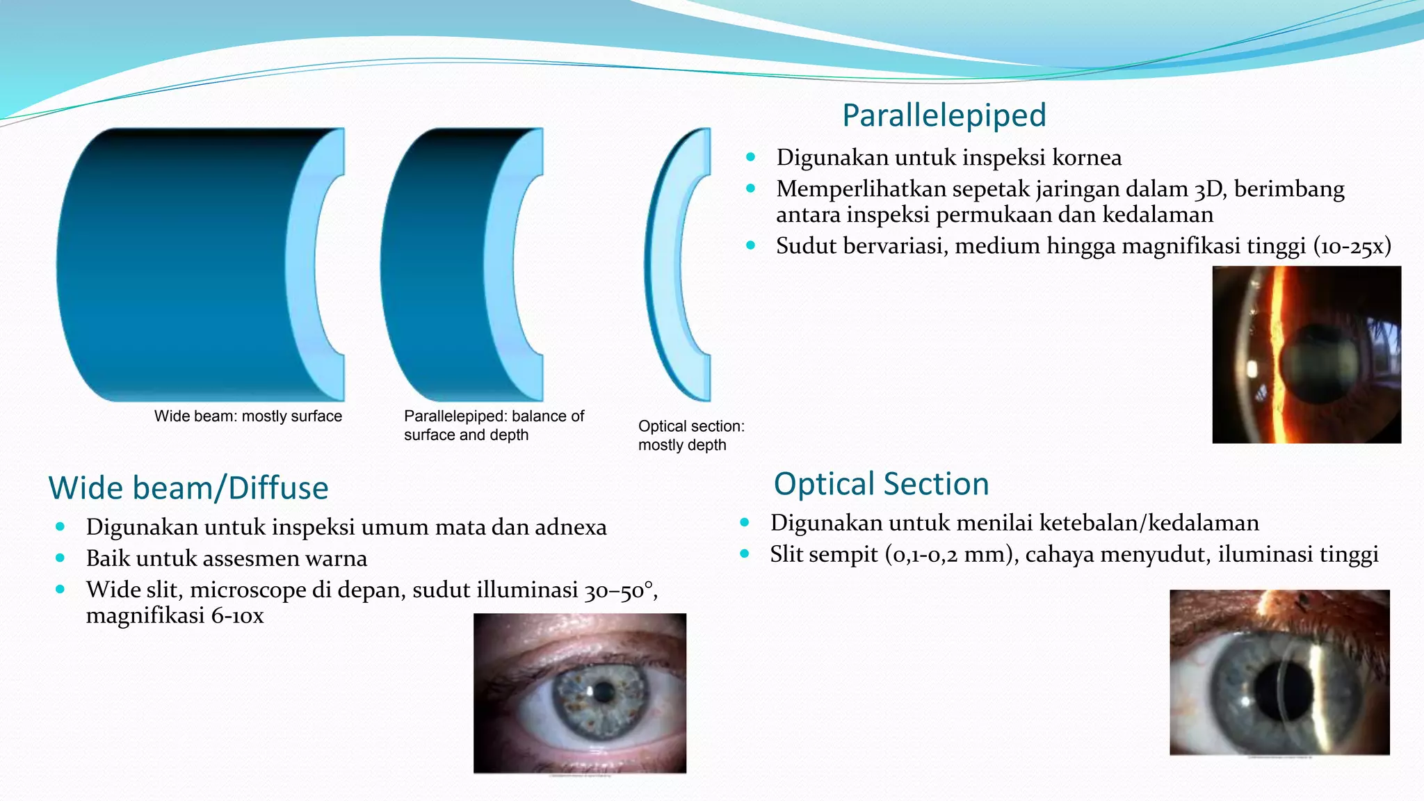 Slit Lamp Biomicroscopy -no.pptx