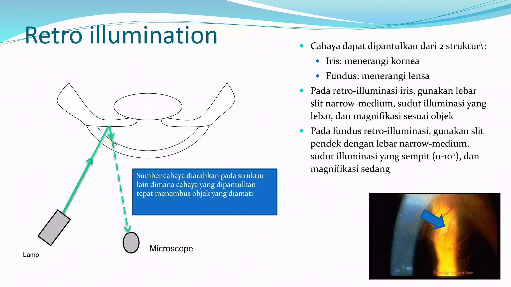 Slit Lamp Biomicroscopy -no.pptx