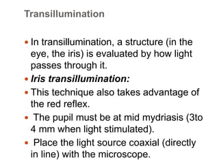 Slit lamp biomicroscopy and operating microscope | PPTX