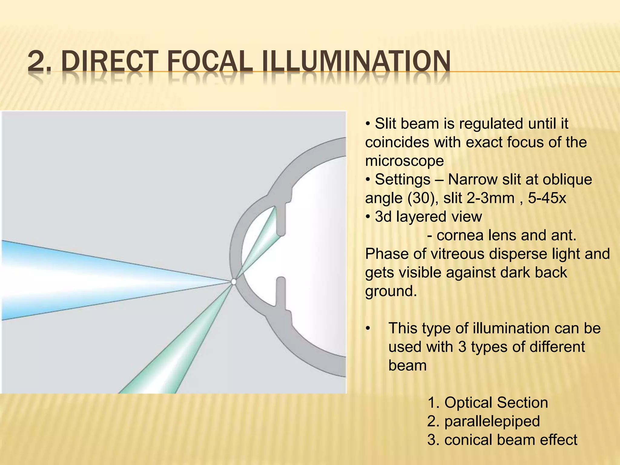 Slit lamp – biomicroscopy of eye | PPTX