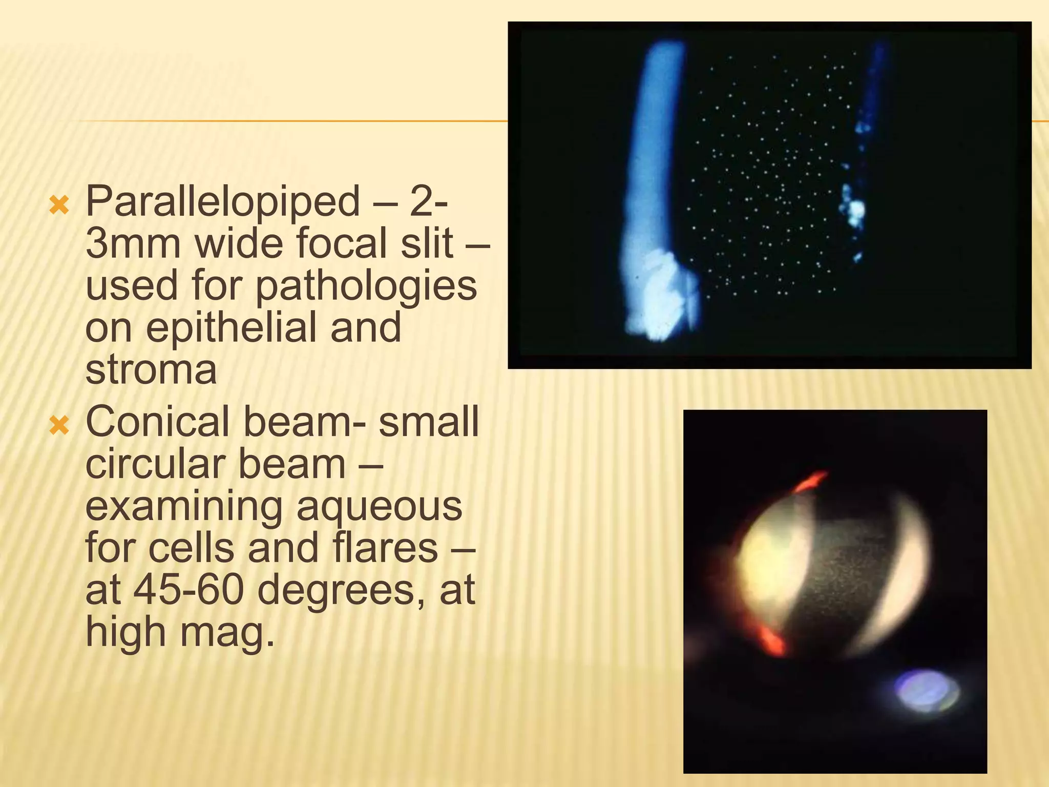Slit lamp – biomicroscopy of eye | PPTX