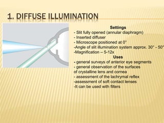 Slit lamp – biomicroscopy of eye | PPTX