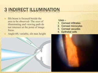 Slit lamp – biomicroscopy of eye | PPTX