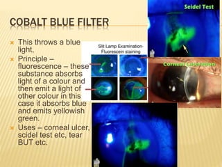 Slit lamp – biomicroscopy of eye | PPTX