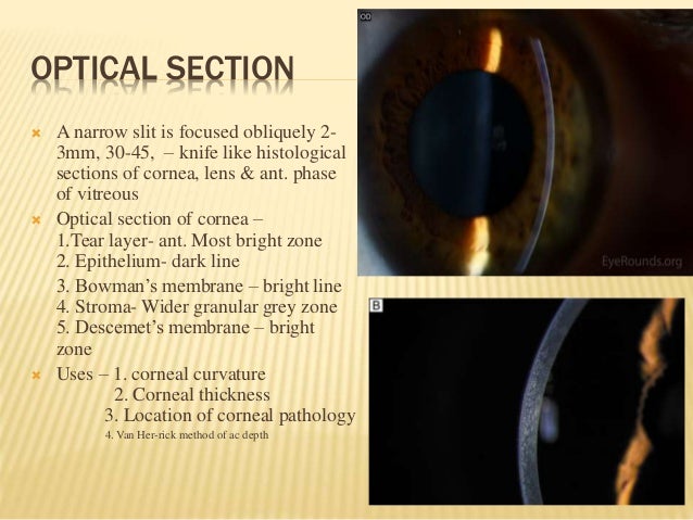 Slit lamp – biomicroscopy of eye