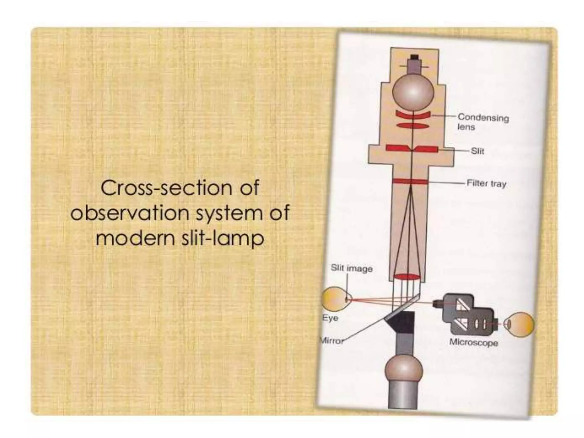 Slit lamp evaluation | PPTX