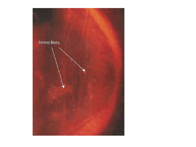 Slit Lamp Evaluation of Cornea | PPTX | Eye and Vision Conditions ...