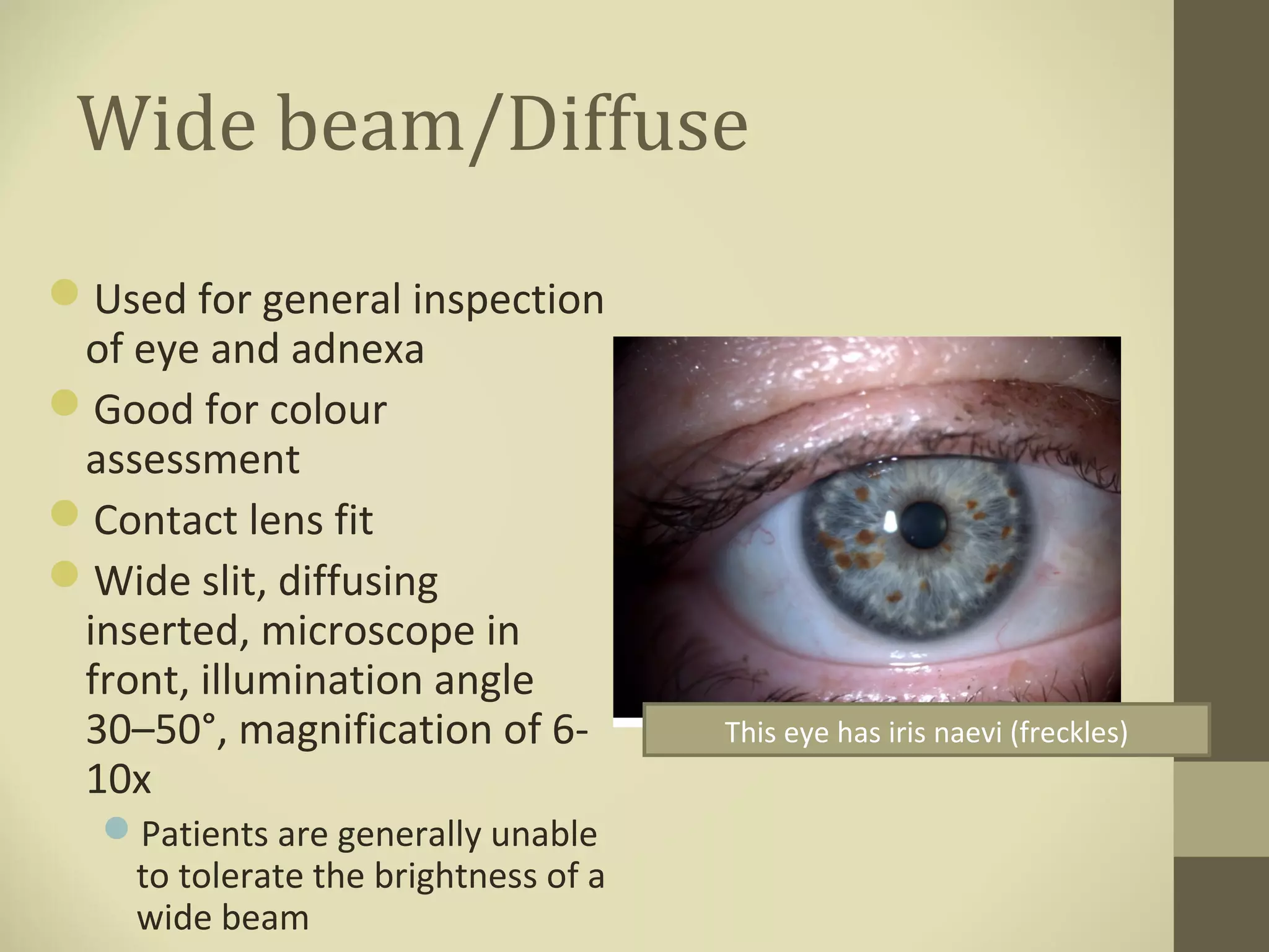 Slit lamp examination | PPT