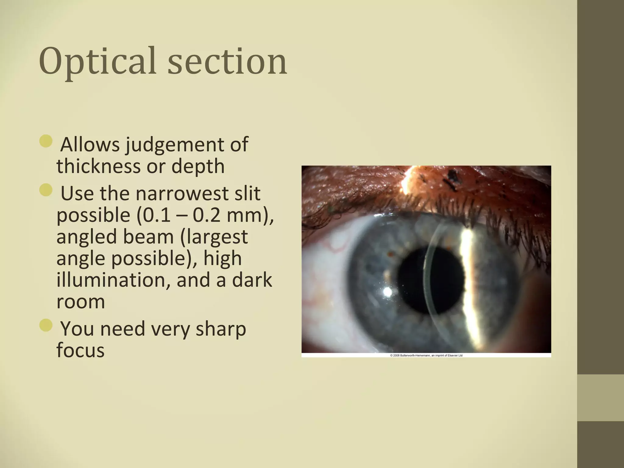 Slit lamp examination | PPT
