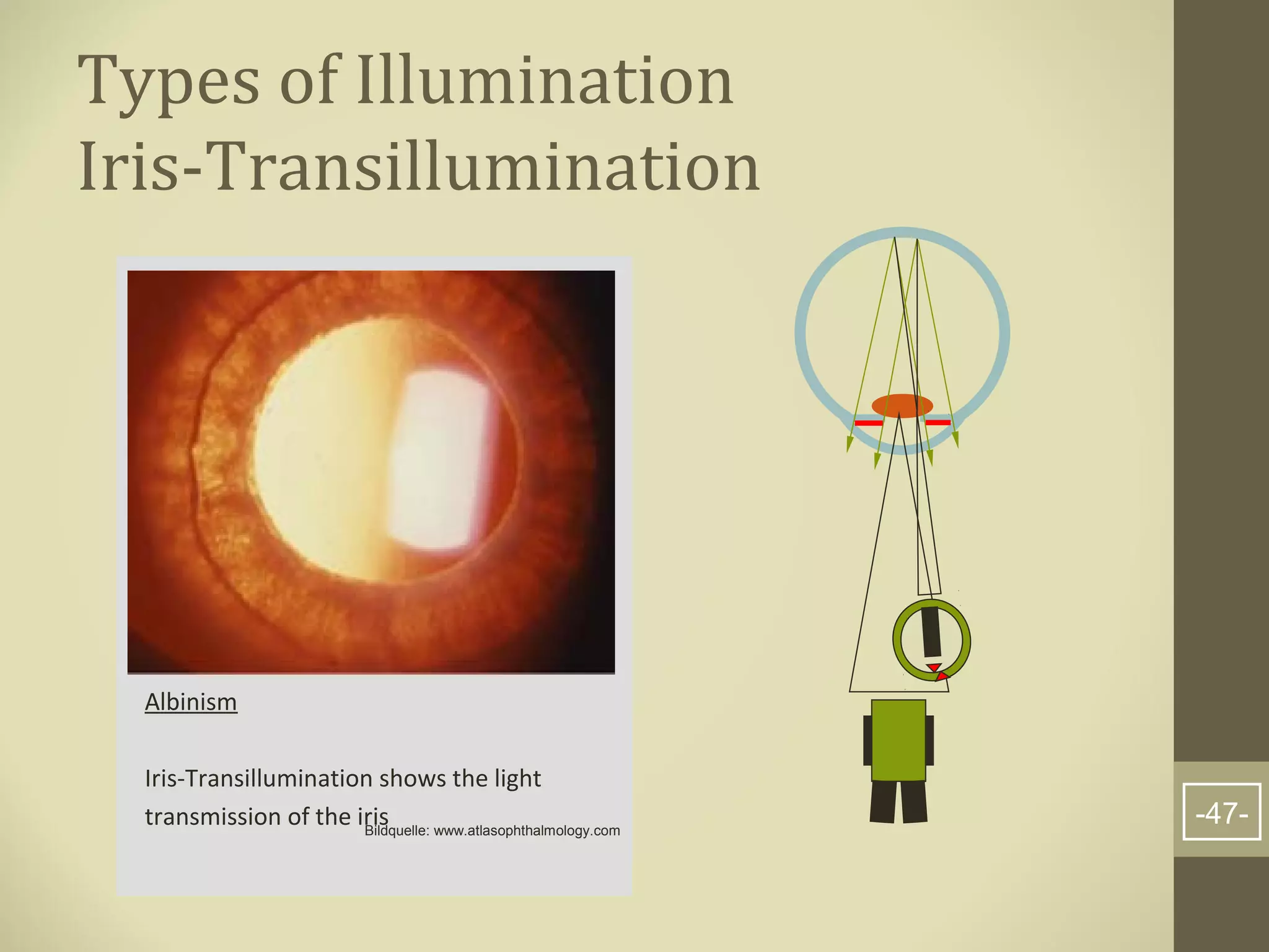 Slit lamp examination | PPT